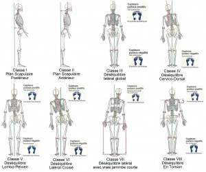 Posturologie | Centre d'ostéopathie et de posturologie du sport à Lille